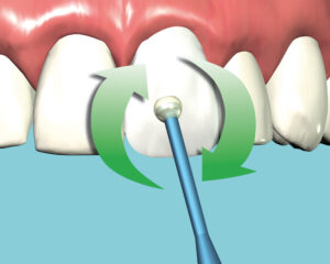 Micro-Stix™ Applicator with adhesive tip - Microbrush® International ...