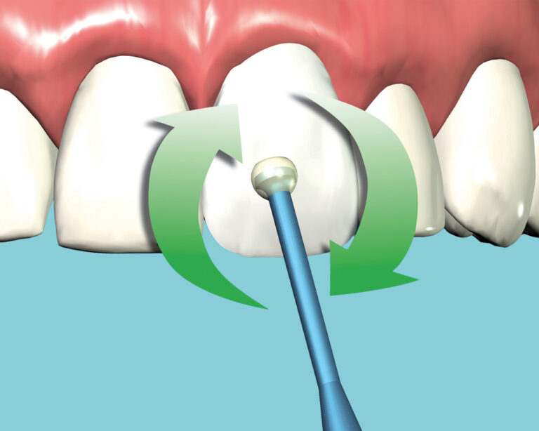 Micro-Stix™ Applicator with adhesive tip - Microbrush® International ...